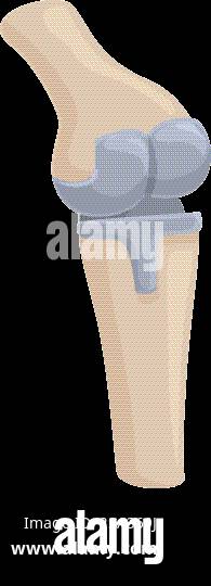 Detailed vector illustration of a human knee joint, showcasing bones ...