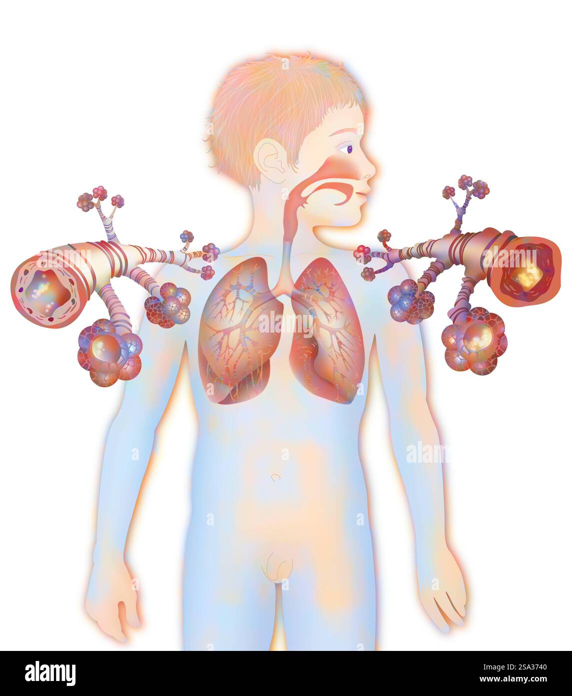 Depiction of a healthy bronchial tube left and a bronchial tube during ...