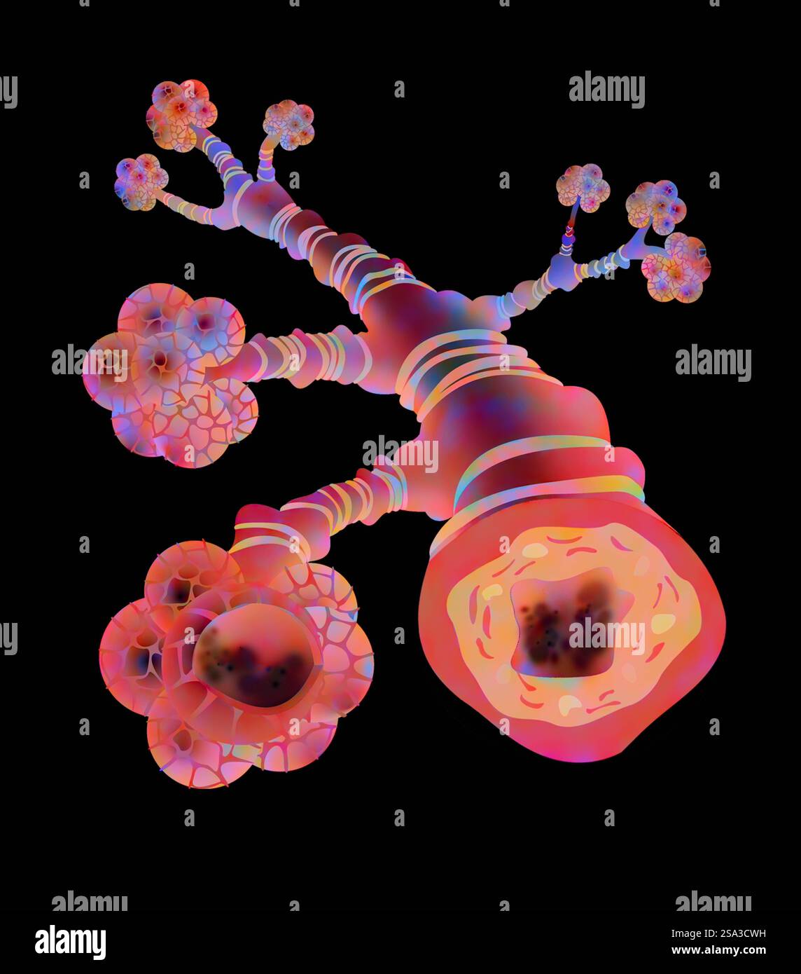 Asthma, drawing Asthma, drawing 016889 258 Stock Photo - Alamy