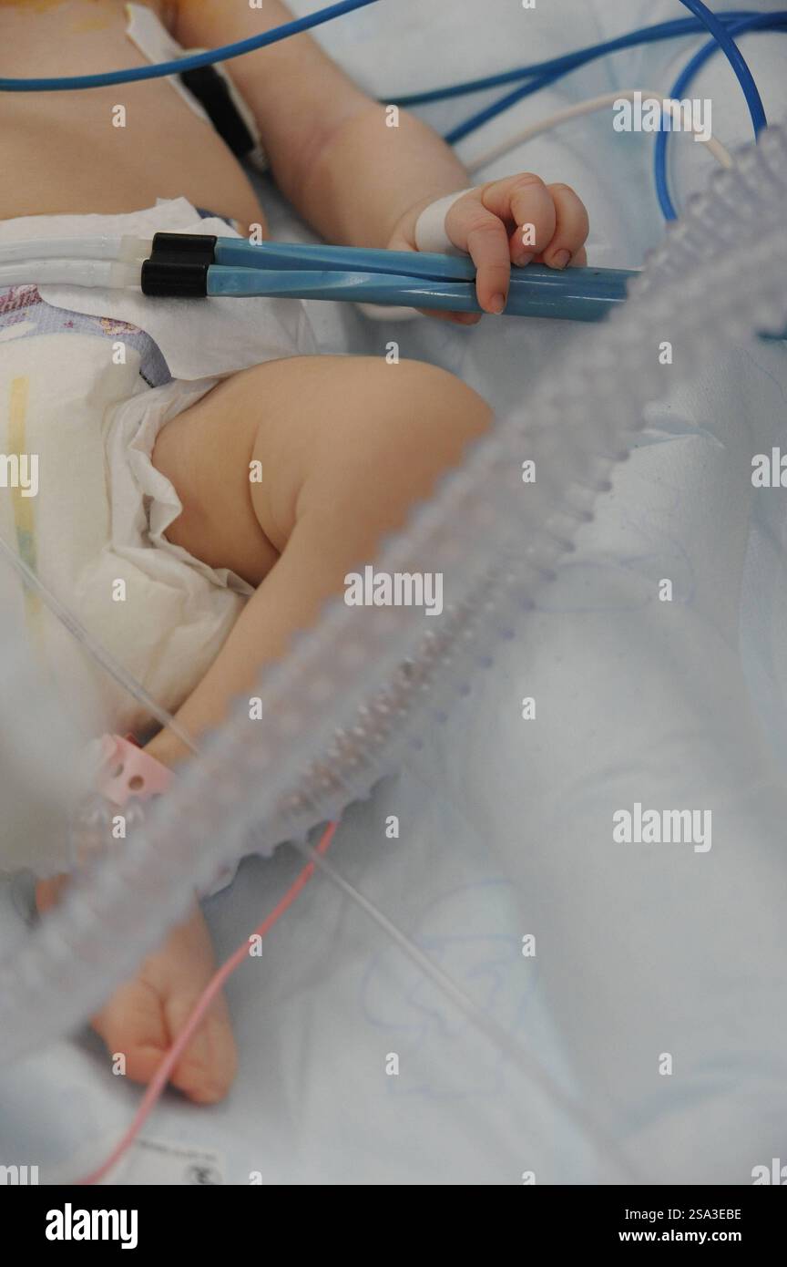 General anesthesia of a child in the operating room. Child anesthesia ...