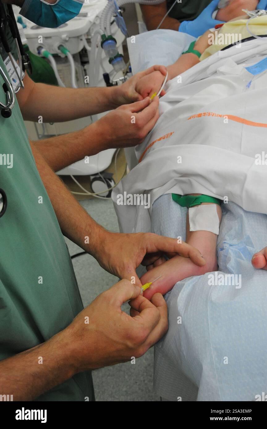 General anesthesia of a child in the operating room. Child anesthesia ...
