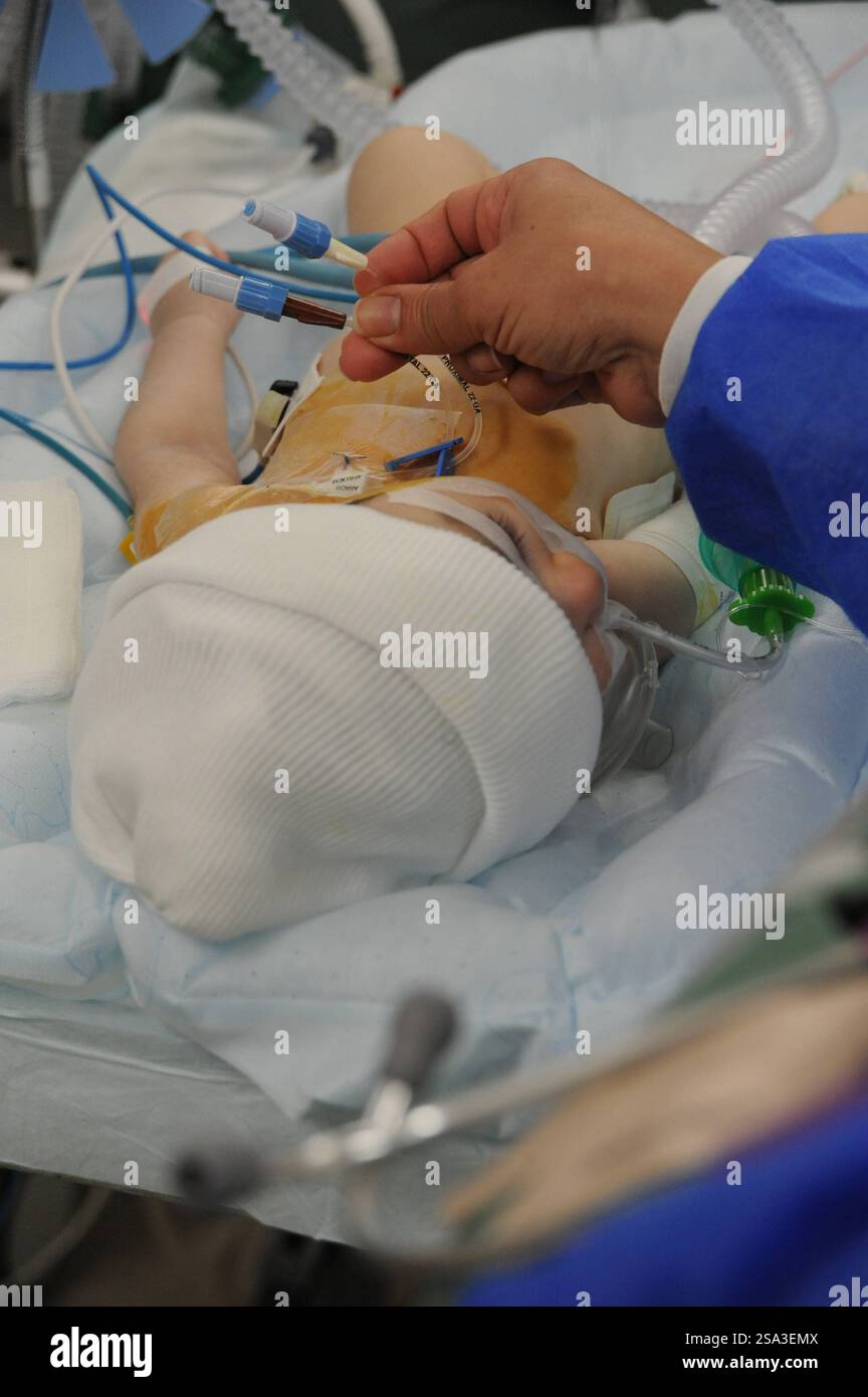 General anesthesia of a child in the operating room. Child anesthesia ...