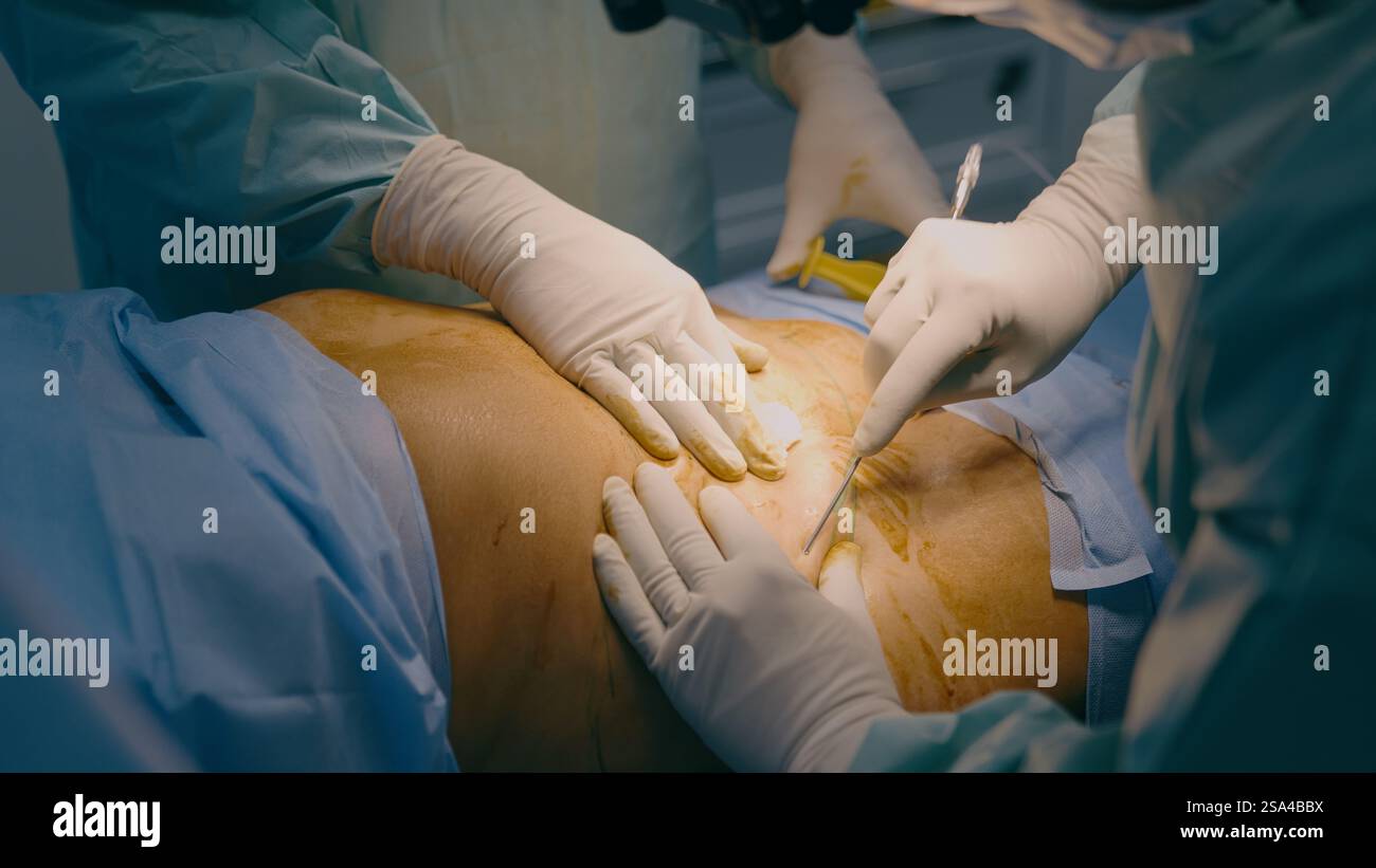 Two doctors men surgeon physician medic help patient operate plastic ...