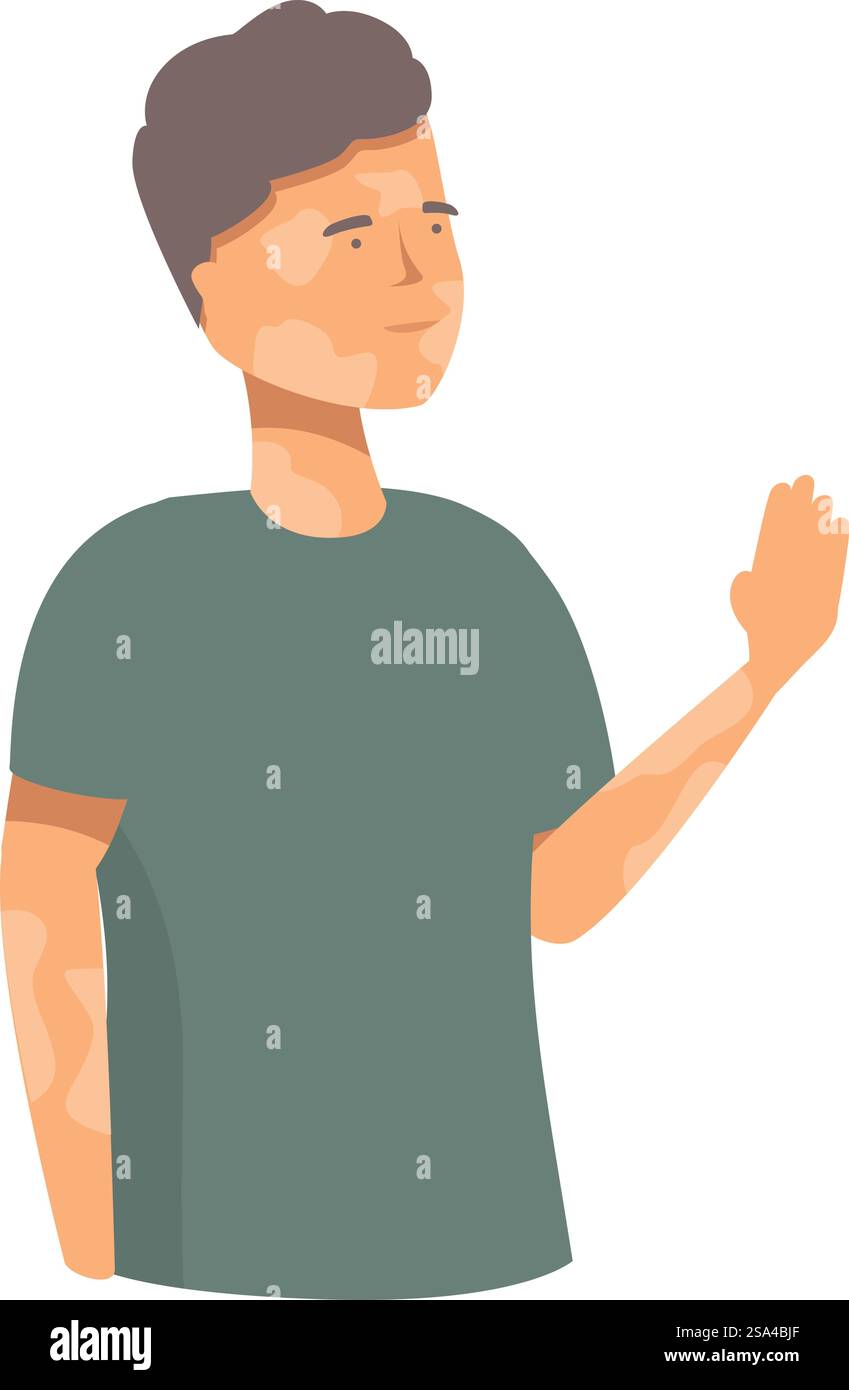 Young man with vitiligo is waving his hand, showing his unique skin ...
