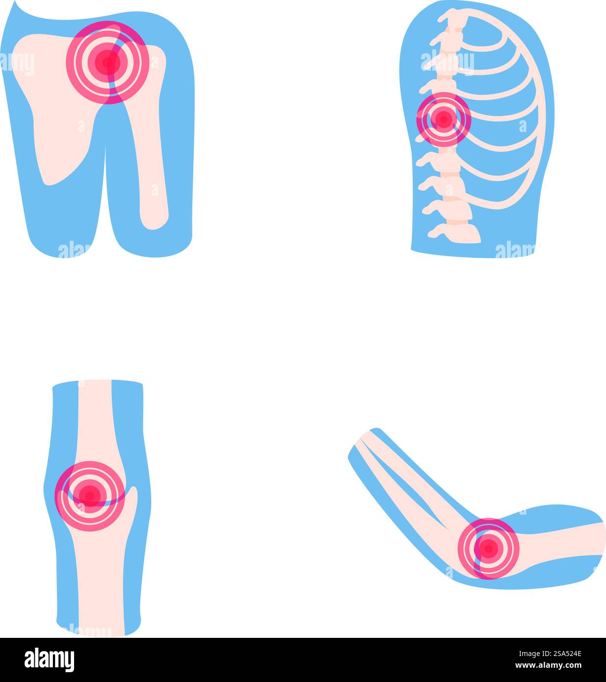 Joint inflammation icons set cartoon vector. Human joint with pain ring ...