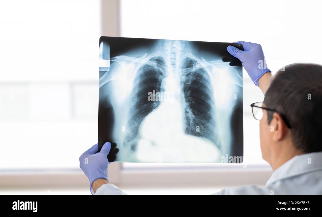 Shot of a young doctor analysing an x ray of a patient’s chest at ...