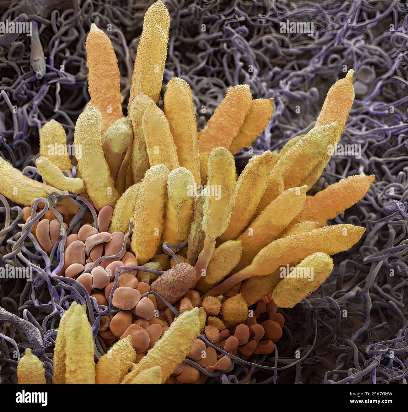 Raspberry rust, SEM Stock Photo - Alamy