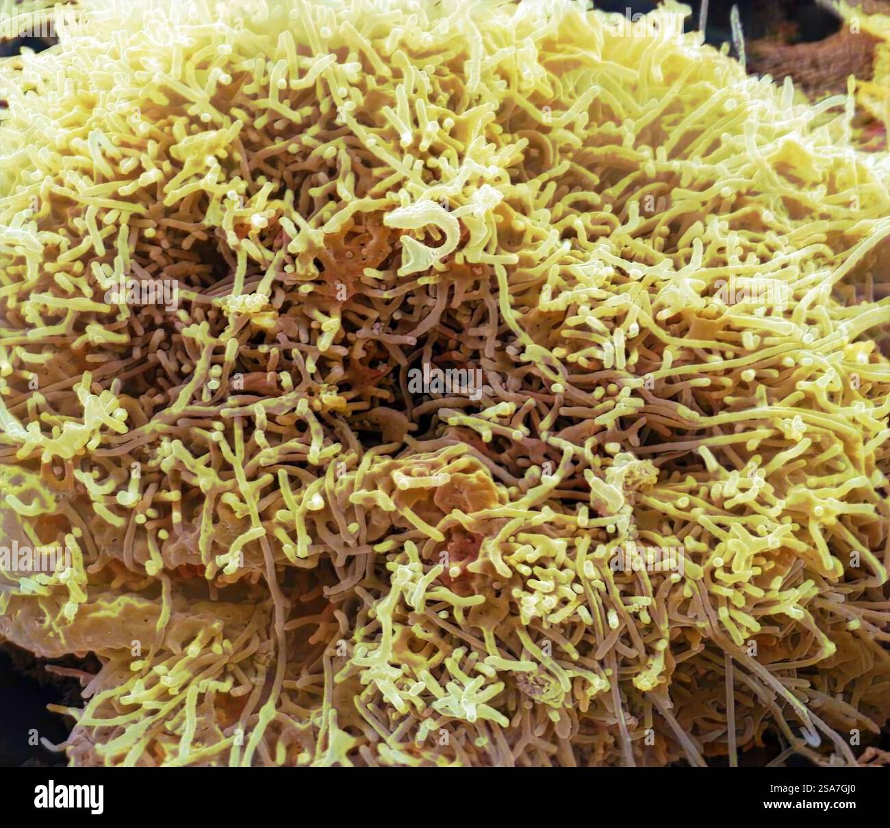 Ebola virus. Coloured scanning electron micrograph (SEM) of Ebola virus ...