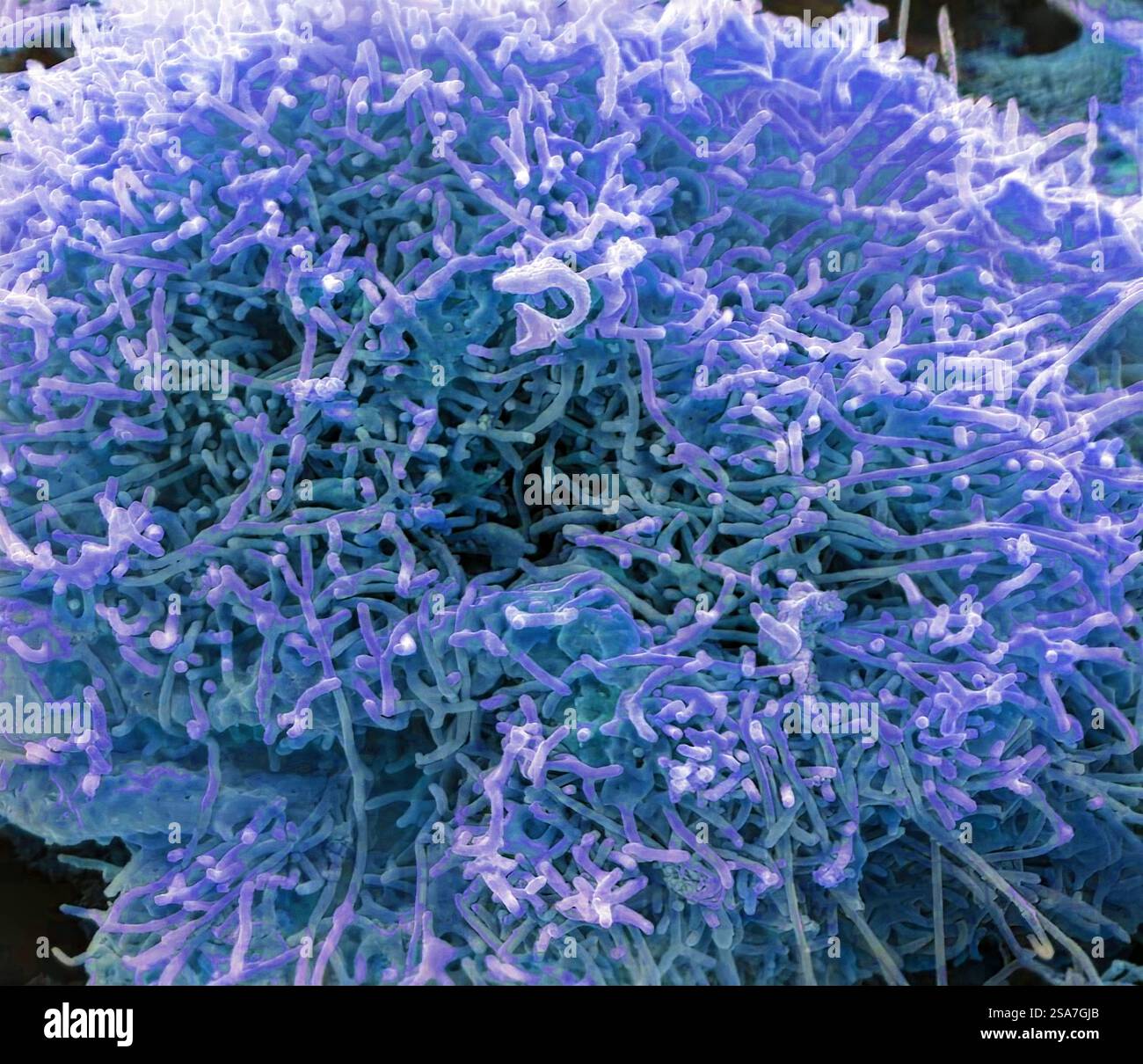 Ebola virus. Coloured scanning electron micrograph (SEM) of Ebola virus ...