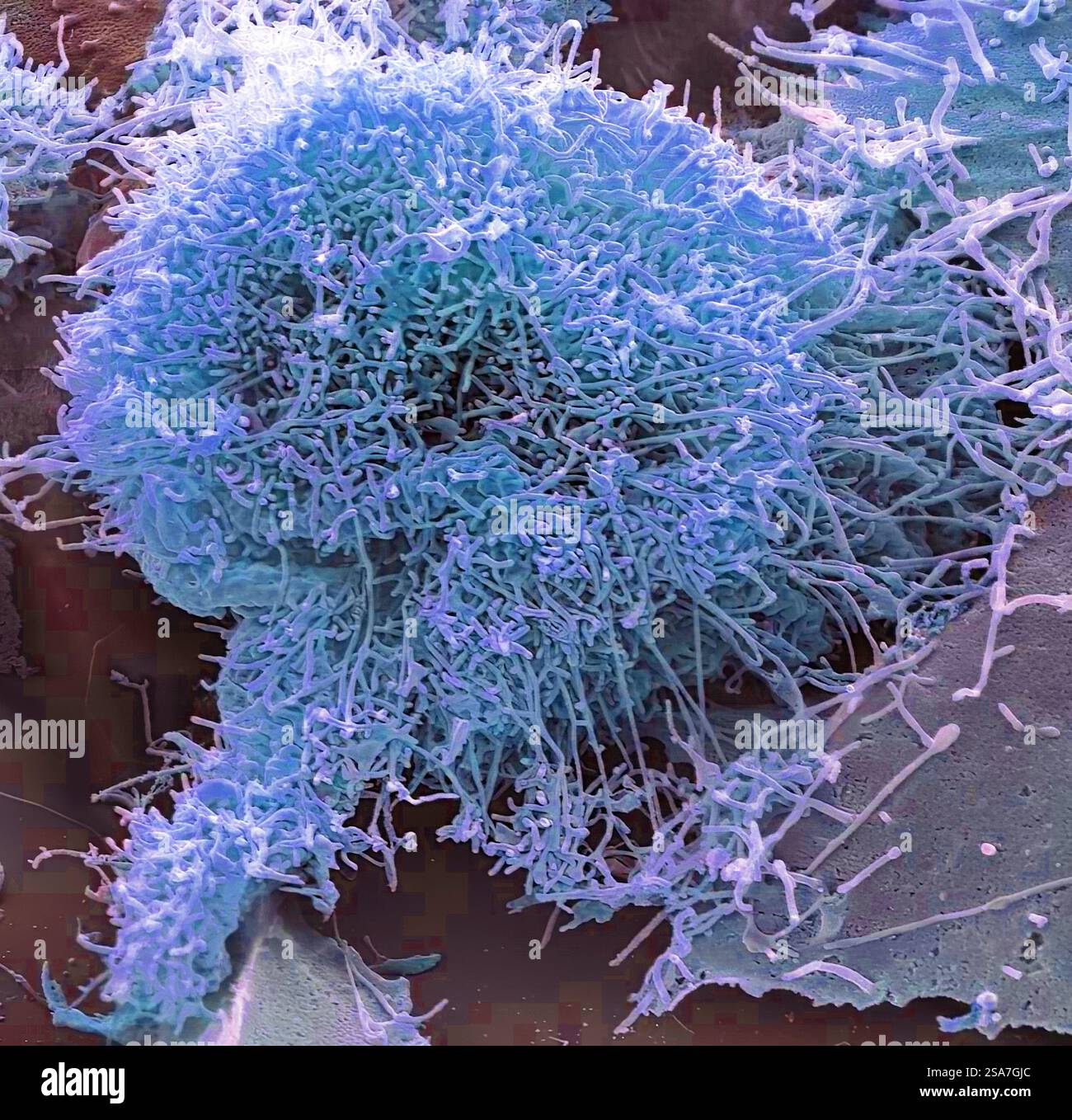 Ebola virus. Coloured scanning electron micrograph (SEM) of Ebola virus ...
