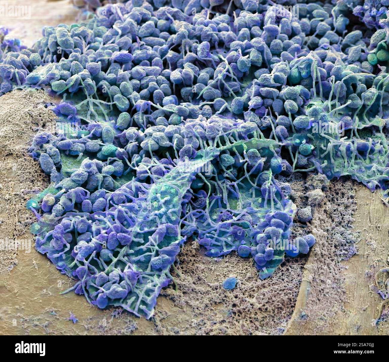 Slime mould spores. Coloured scanning electron micrograph (SEM) of the ...