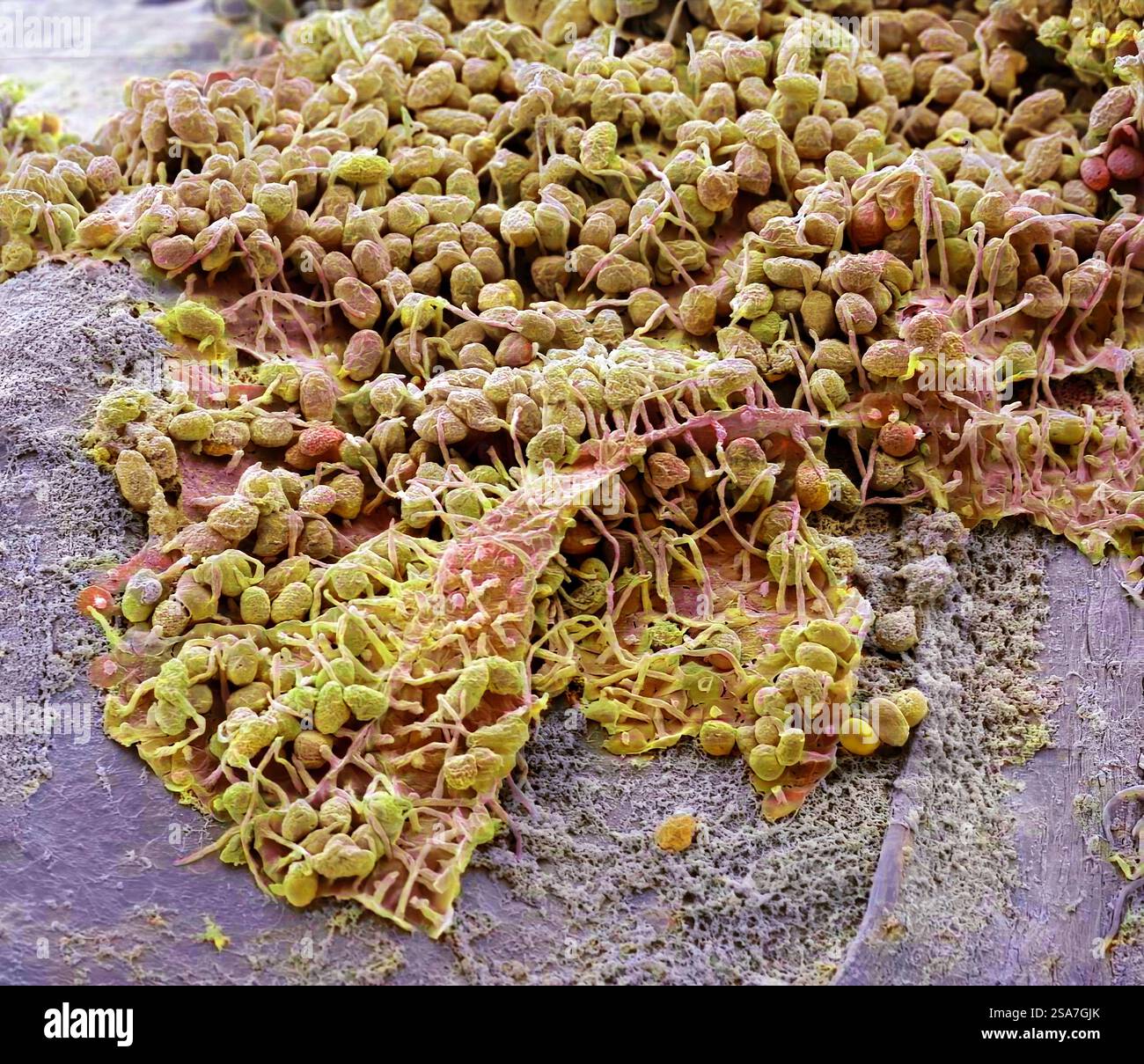 Slime mould spores. Coloured scanning electron micrograph (SEM) of the ...