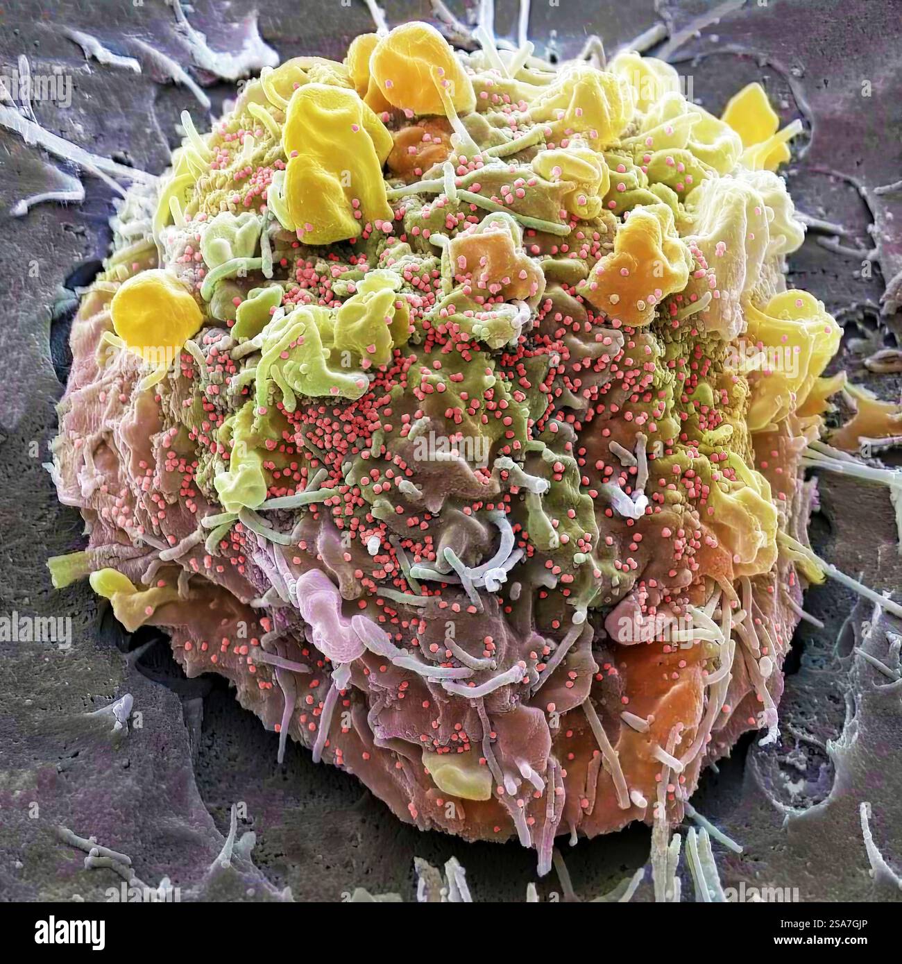 SARS-CoV-2. Coloured scanning electron micrograph (SEM). Here the virus ...