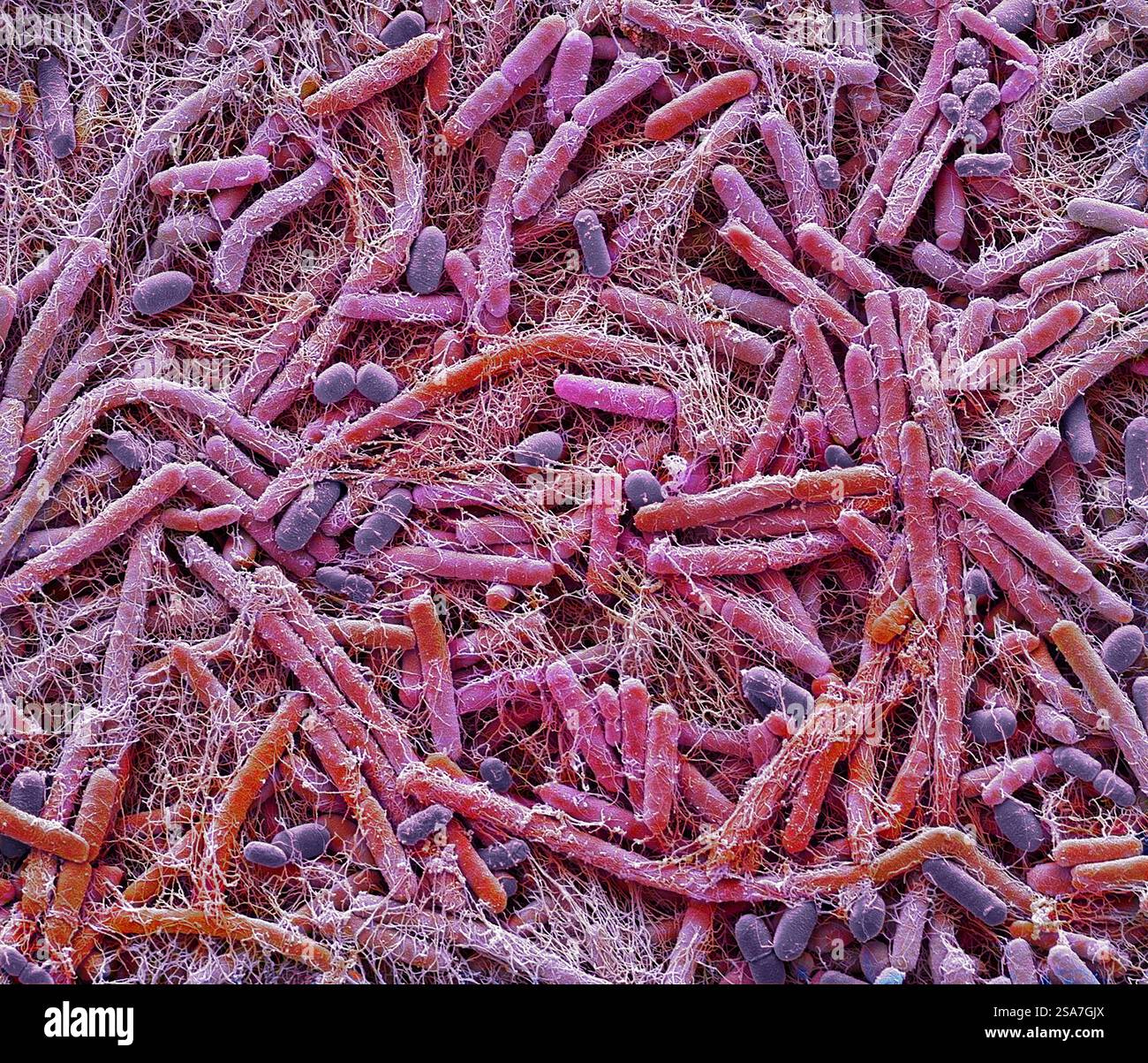 Bacteria from a house fly, SEM Stock Photo - Alamy