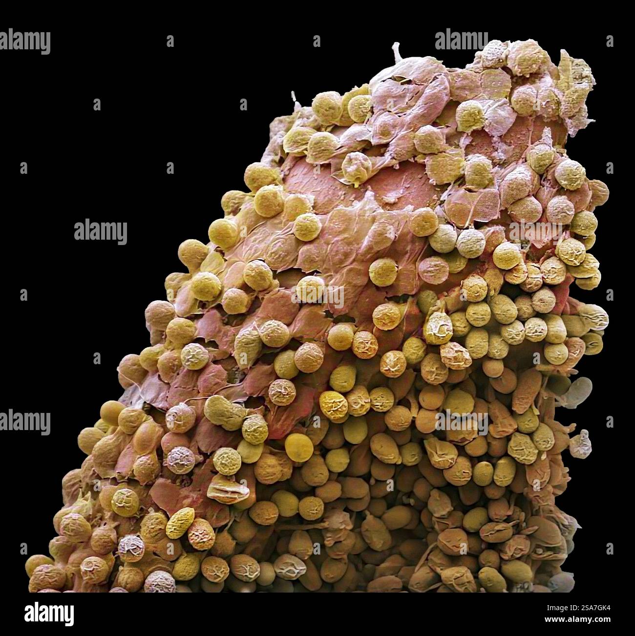 Slime mould spores. Coloured scanning electron micrograph (SEM) of the ...