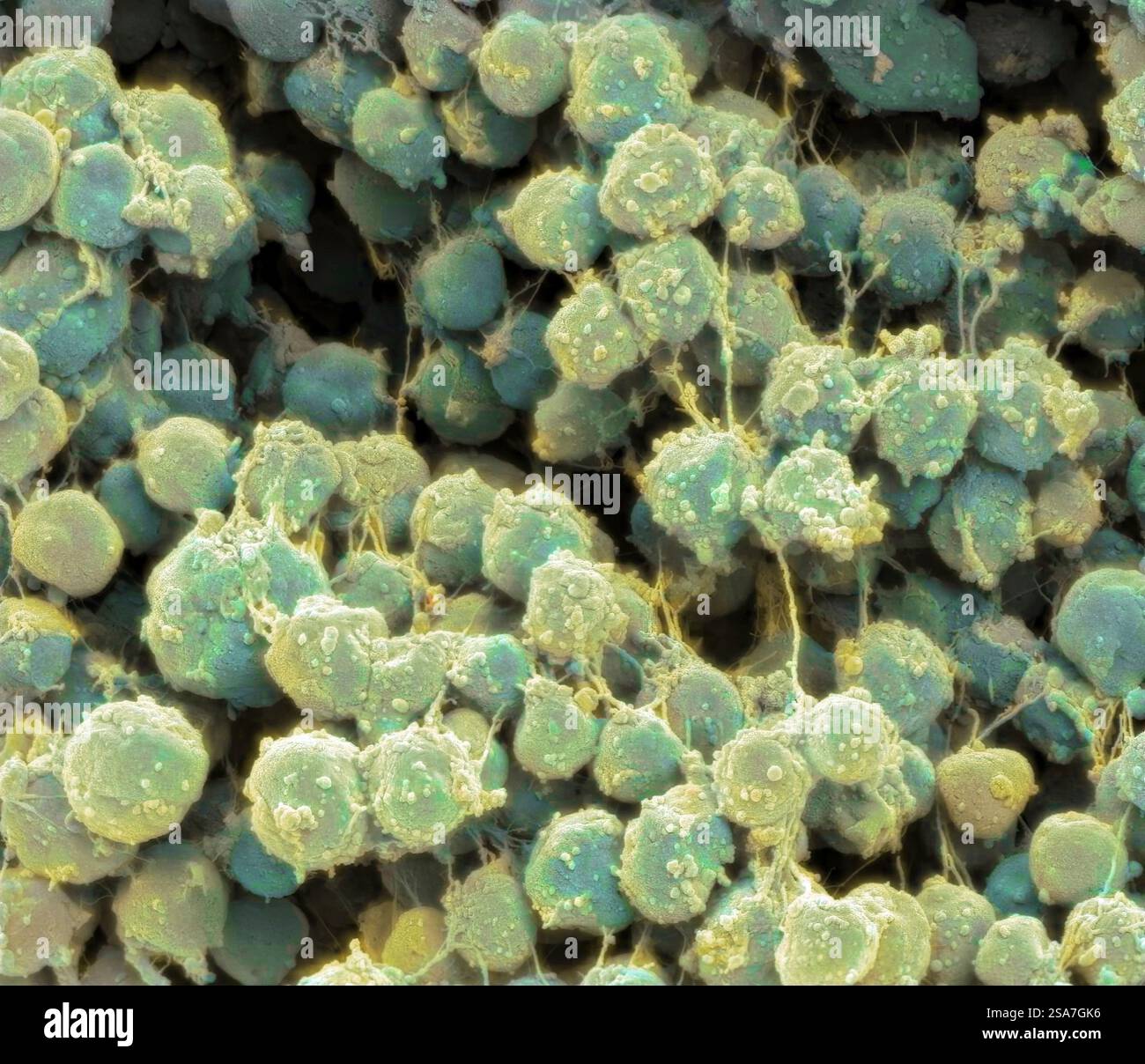 Archaea, coloured scanning electron micrograph (SEM). Archaea are a ...