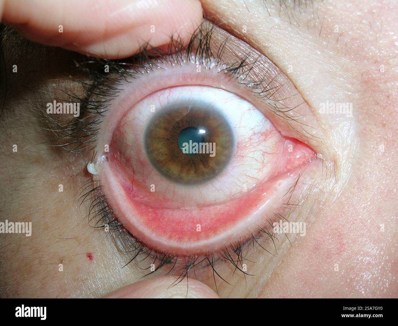 Not to be used for advertising or in a defamatory context Ocular ...