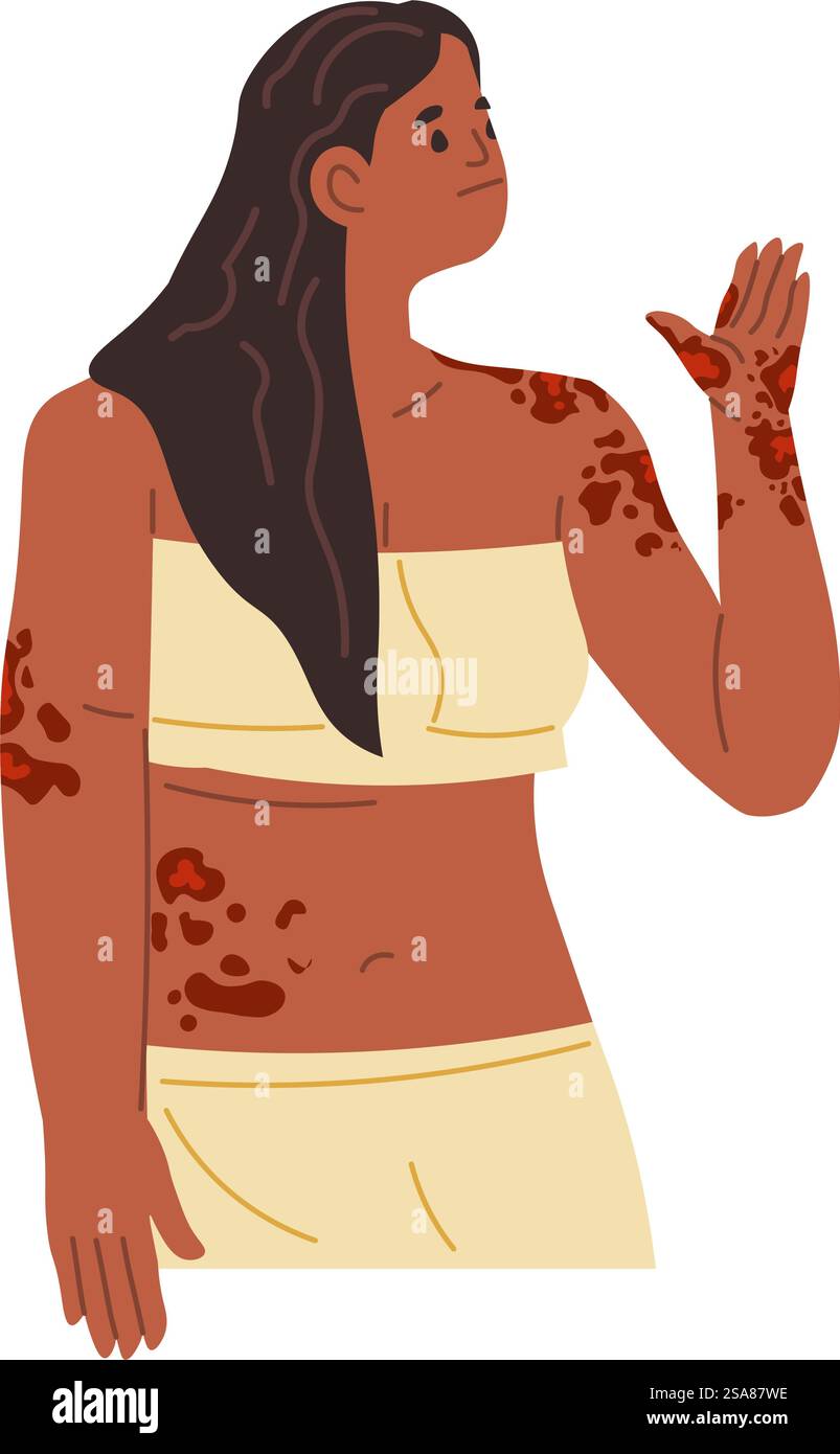 Illustration of a woman with a skin rash on her arm. The style is ...