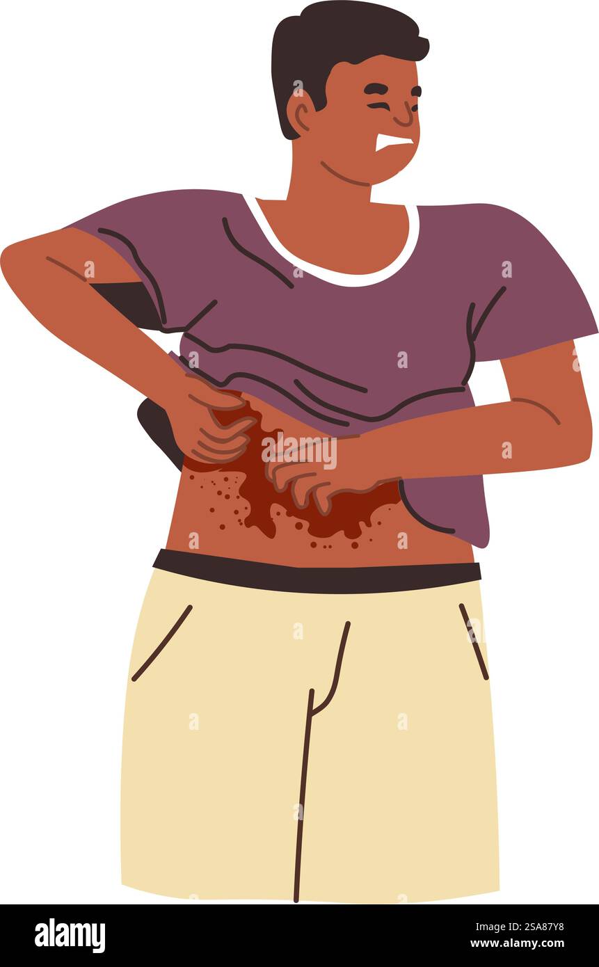 Illustration of a man scratching a skin rash on his stomach. The style ...