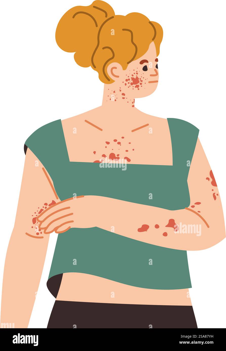 Illustration of a woman with a skin rash on her arm. The style is ...