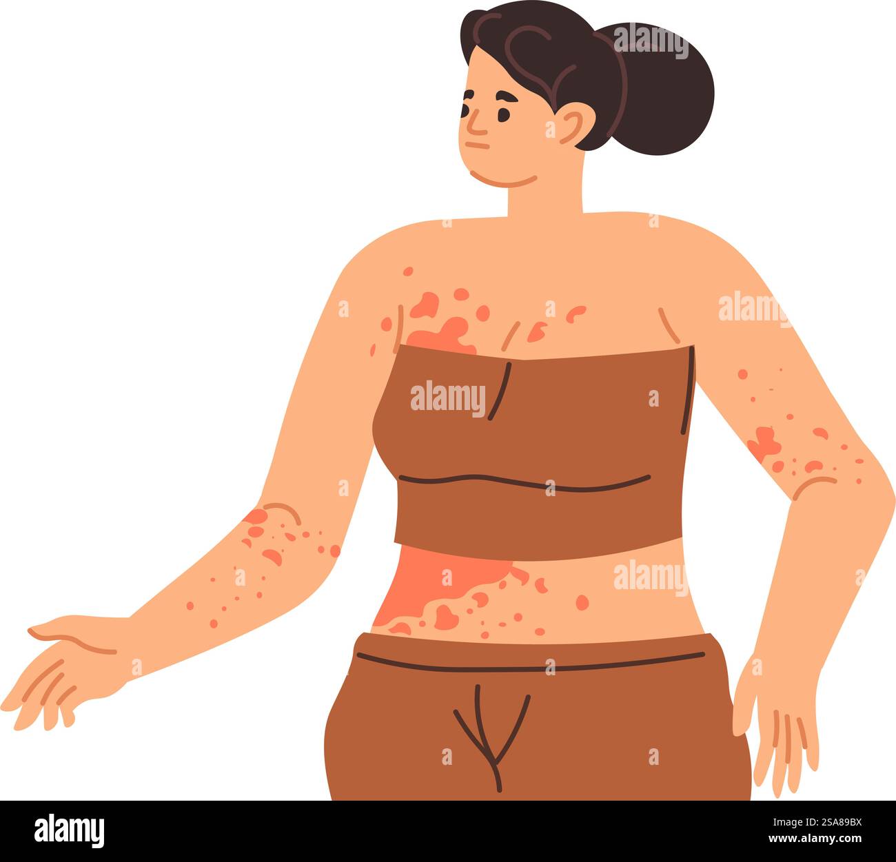 Illustration of a woman with a skin rash on her arm. The style is ...