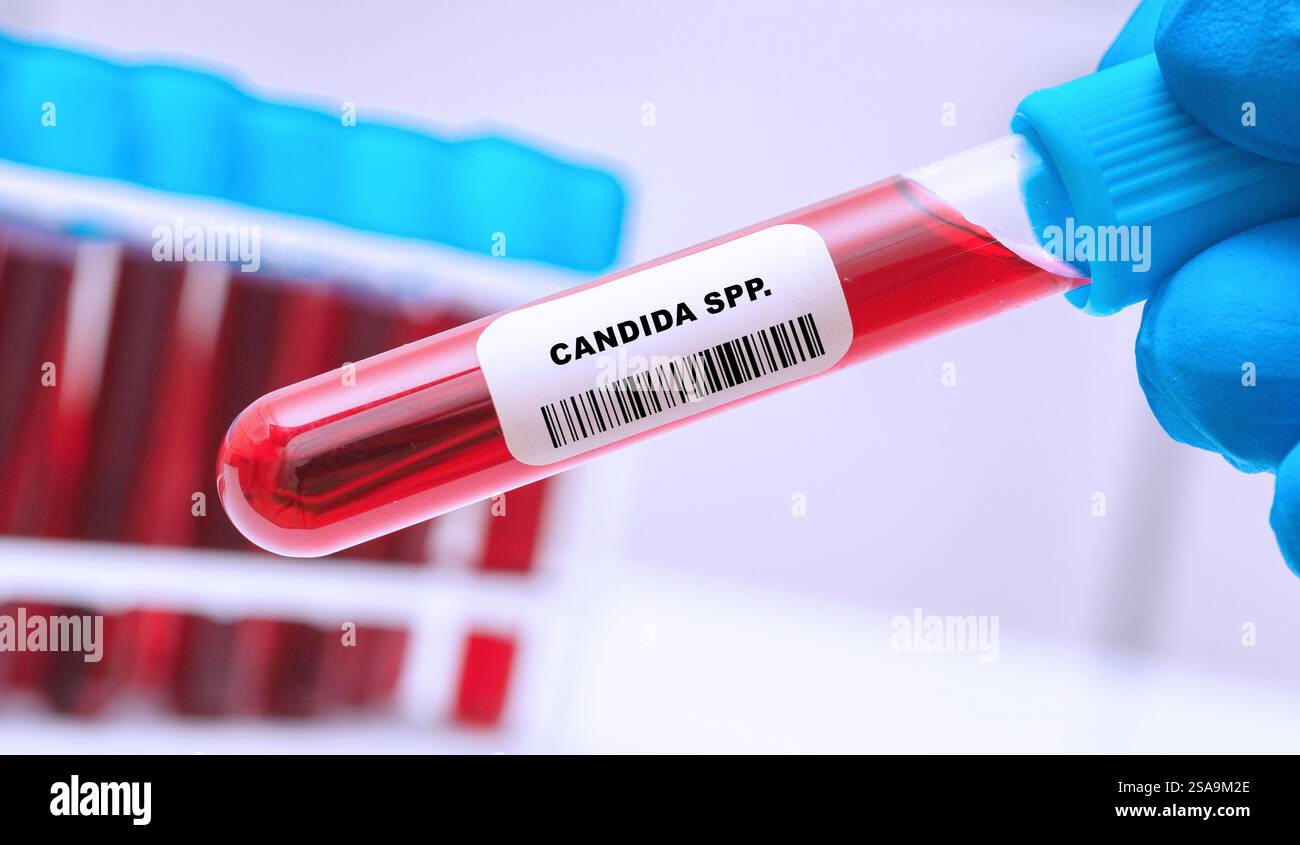 Candida spp. Some species can be used as probiotics Stock Photo - Alamy