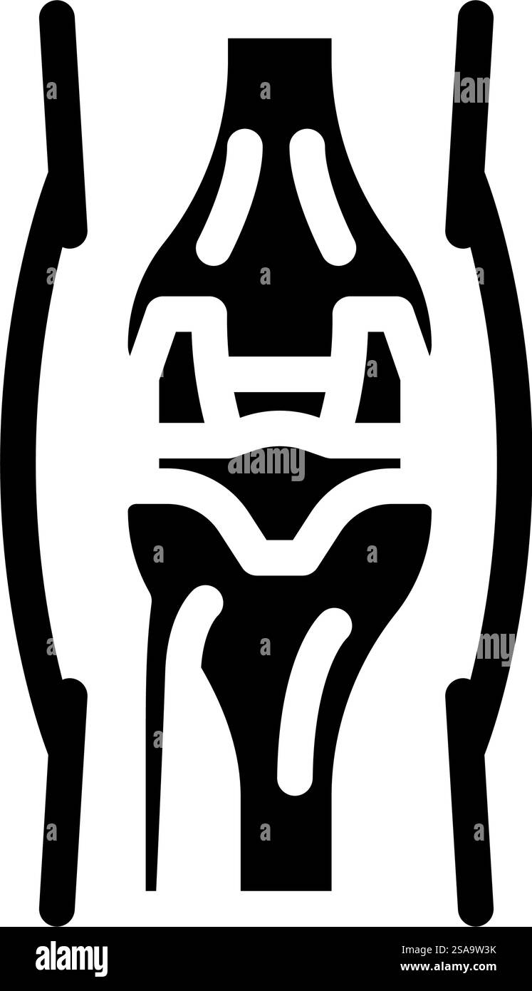 joint replacement surgery glyph icon vector. joint replacement surgery ...