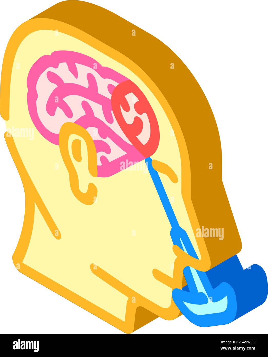 lobotomy surgery isometric icon vector. lobotomy surgery sign. isolated ...