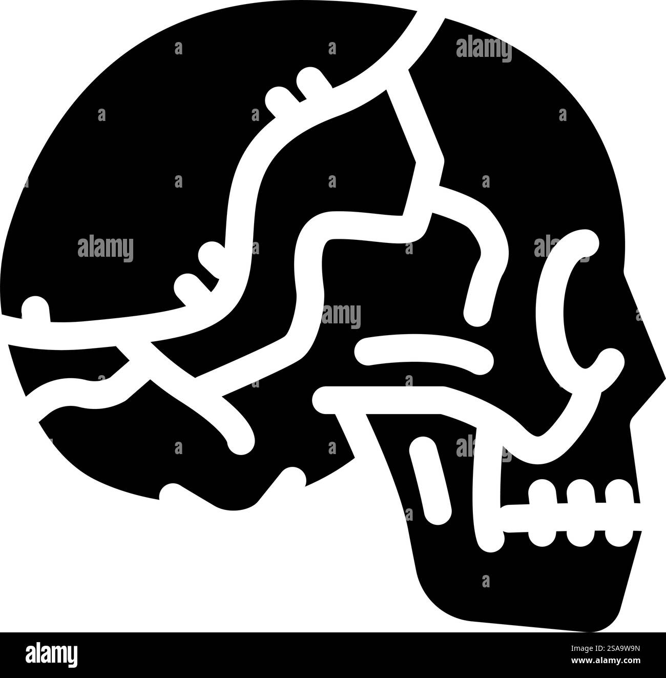 cranioplasty surgery glyph icon vector. cranioplasty surgery sign ...