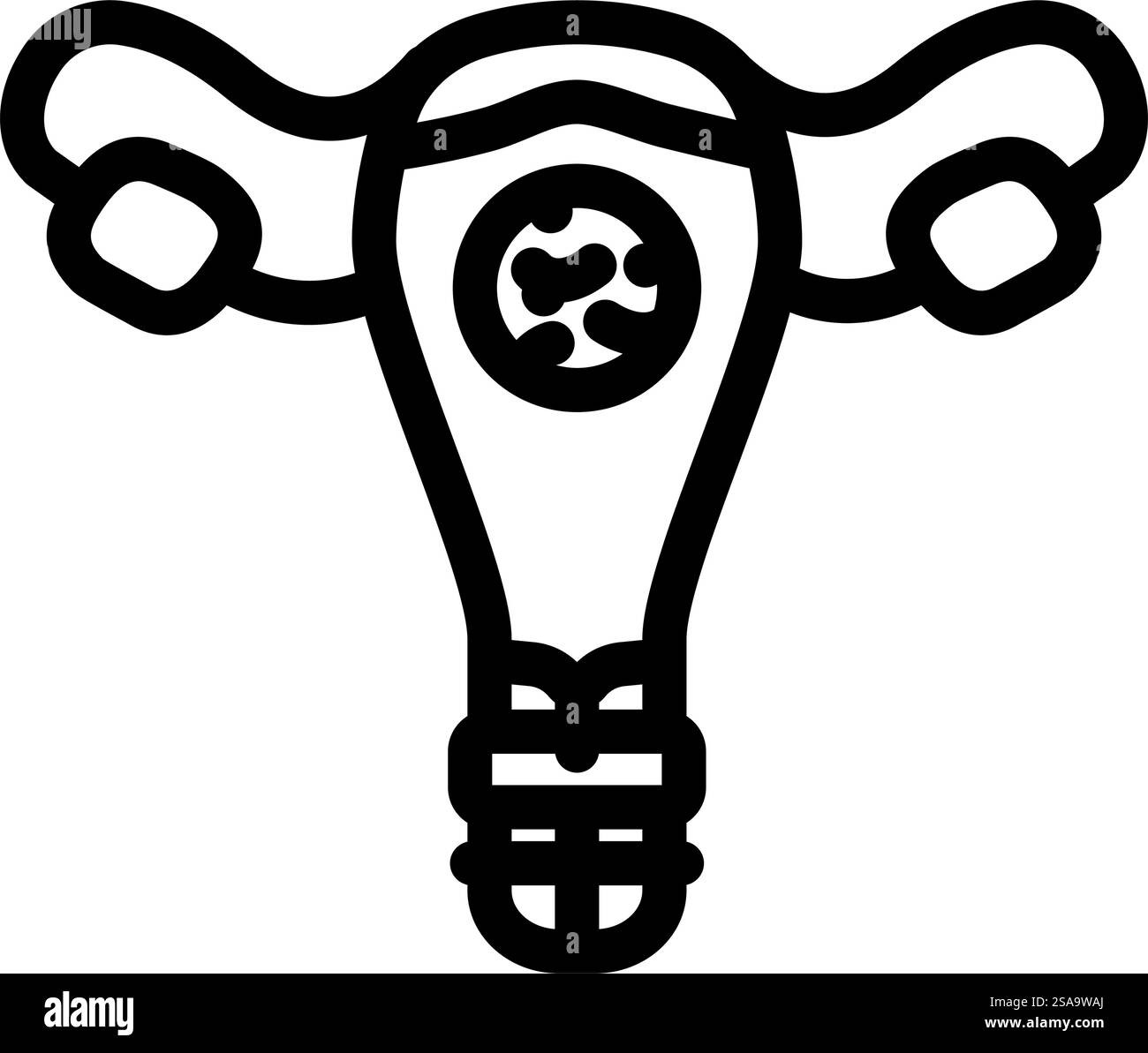 Cervical cerclage Black and White Stock Photos & Images - Alamy