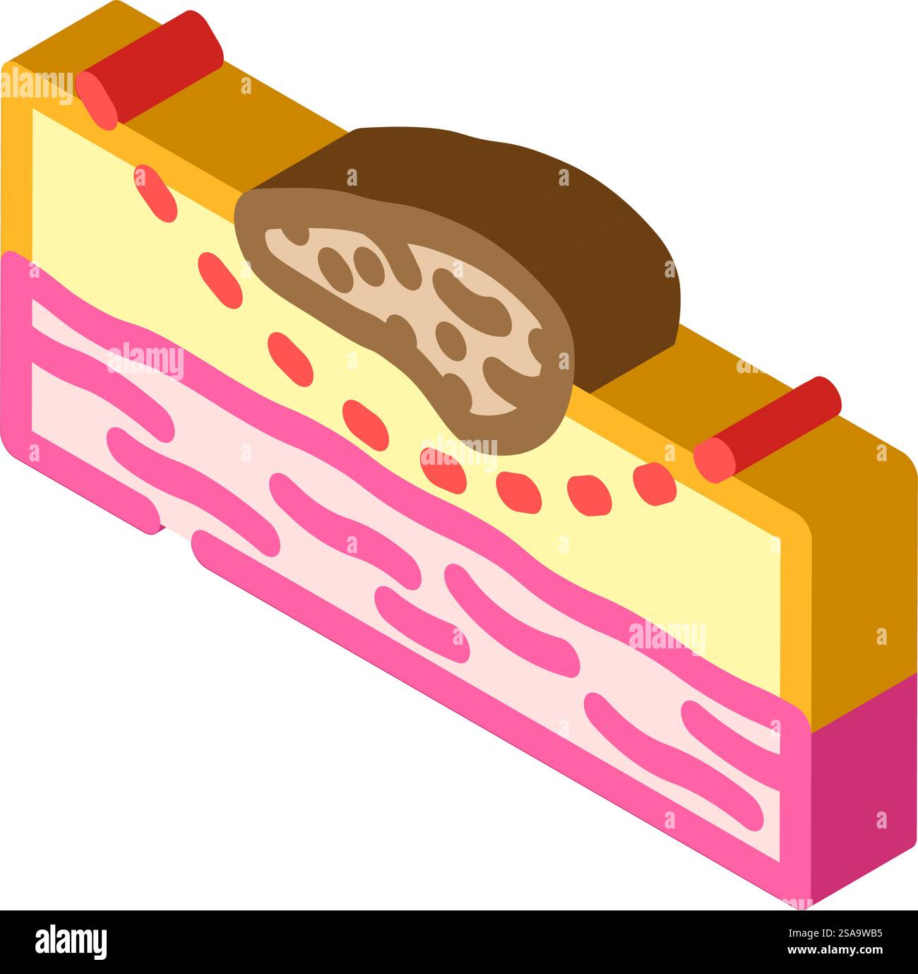 excisional biopsy surgery isometric icon vector. excisional biopsy ...
