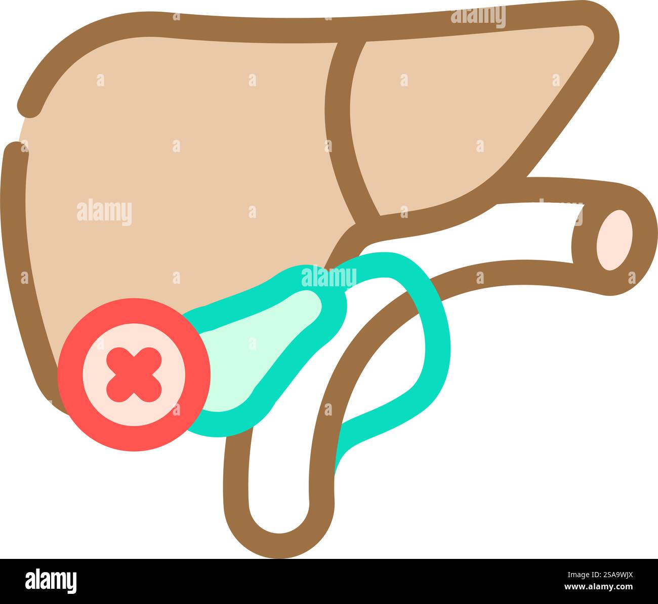 cholecystectomy surgery color icon vector. cholecystectomy surgery sign ...