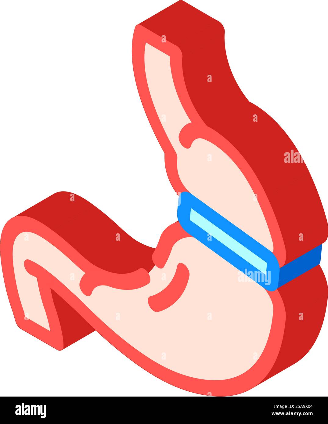 bariatric surgery obesity overweight isometric icon vector. bariatric ...