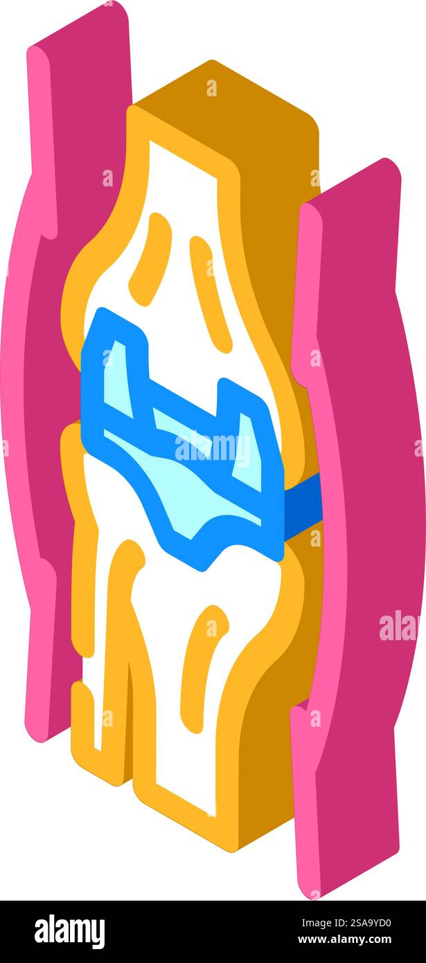 joint replacement surgery isometric icon vector. joint replacement ...