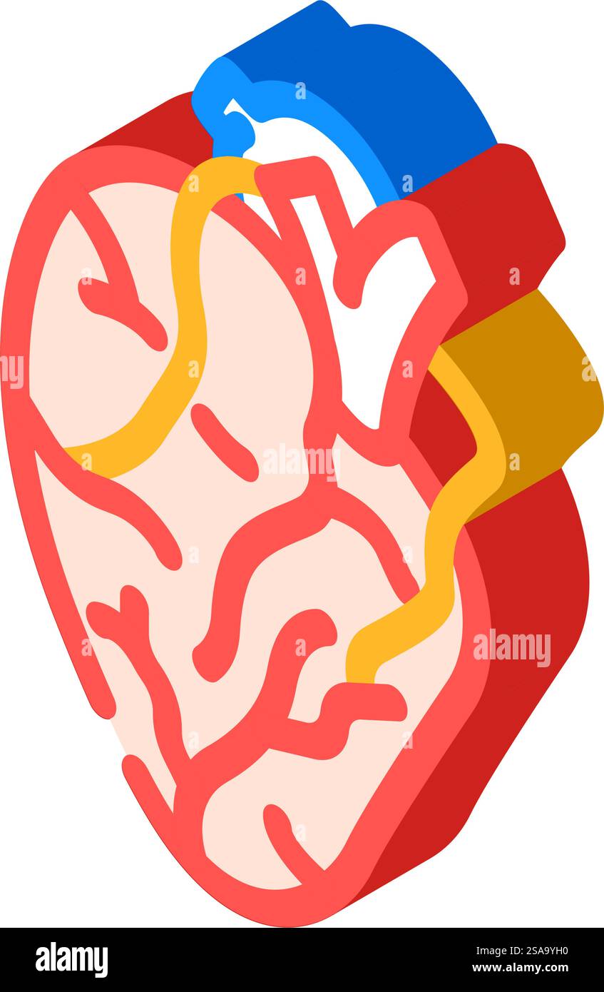 bypass surgery surgery isometric icon vector. bypass surgery surgery ...