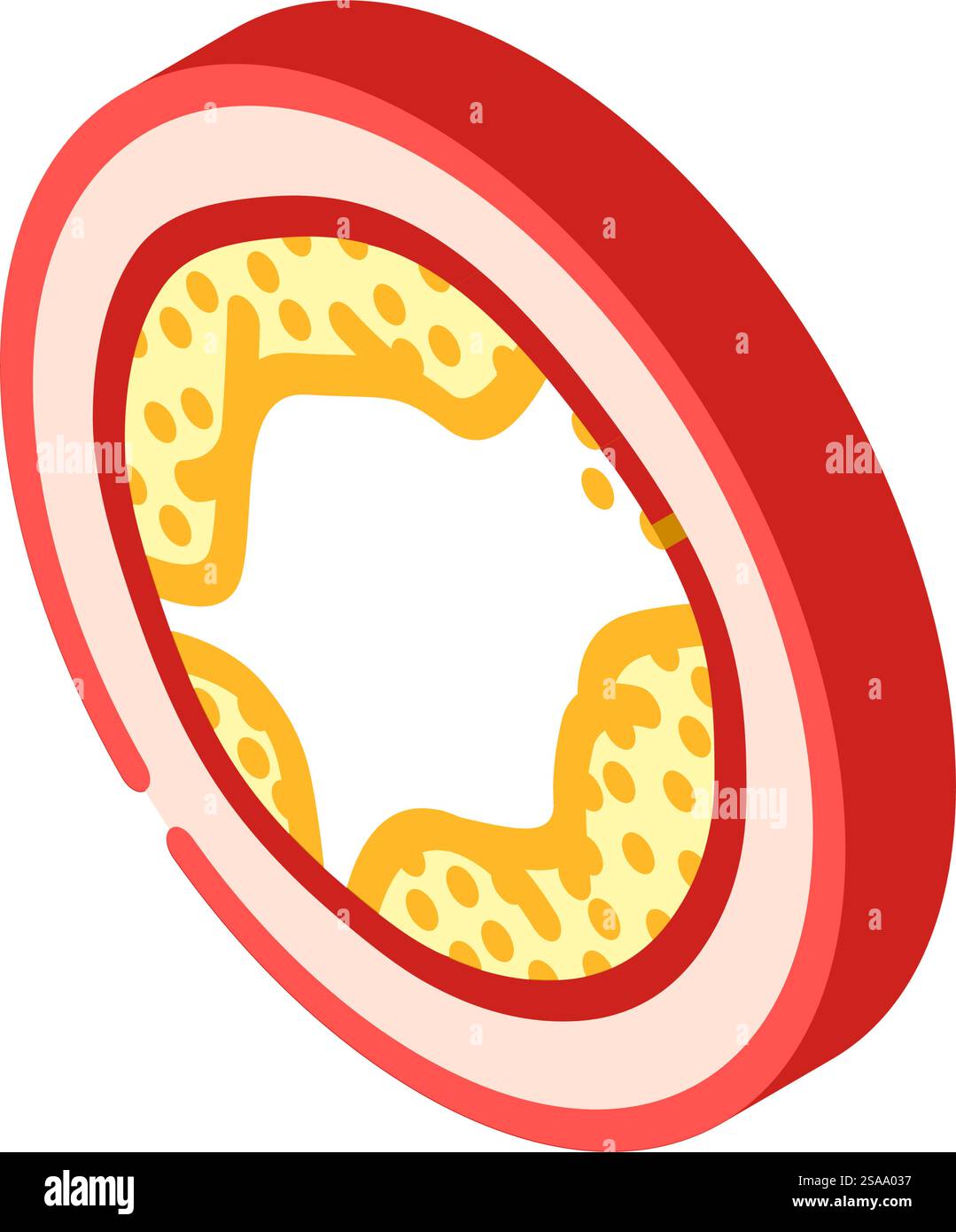 high cholesterol obesity overweight isometric icon vector. high ...