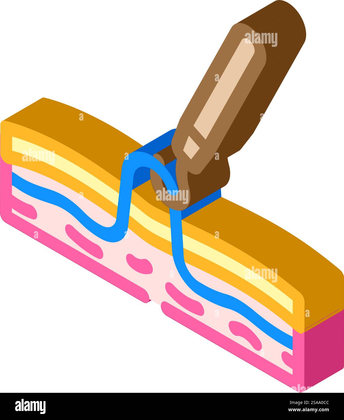 phlebectomy surgery isometric icon vector. phlebectomy surgery sign ...
