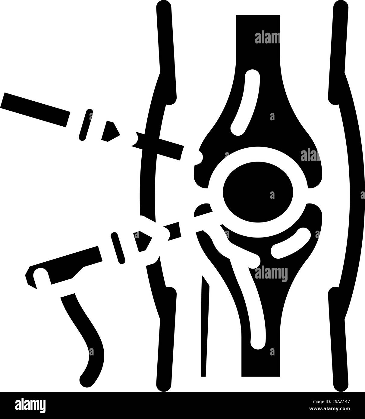 arthroscopy surgery glyph icon vector. arthroscopy surgery sign ...