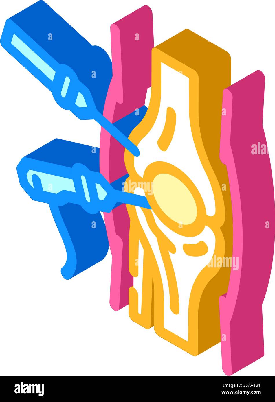 arthroscopy surgery isometric icon vector. arthroscopy surgery sign ...