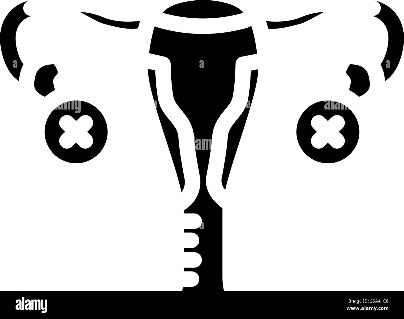oophorectomy surgery glyph icon vector. oophorectomy surgery sign ...