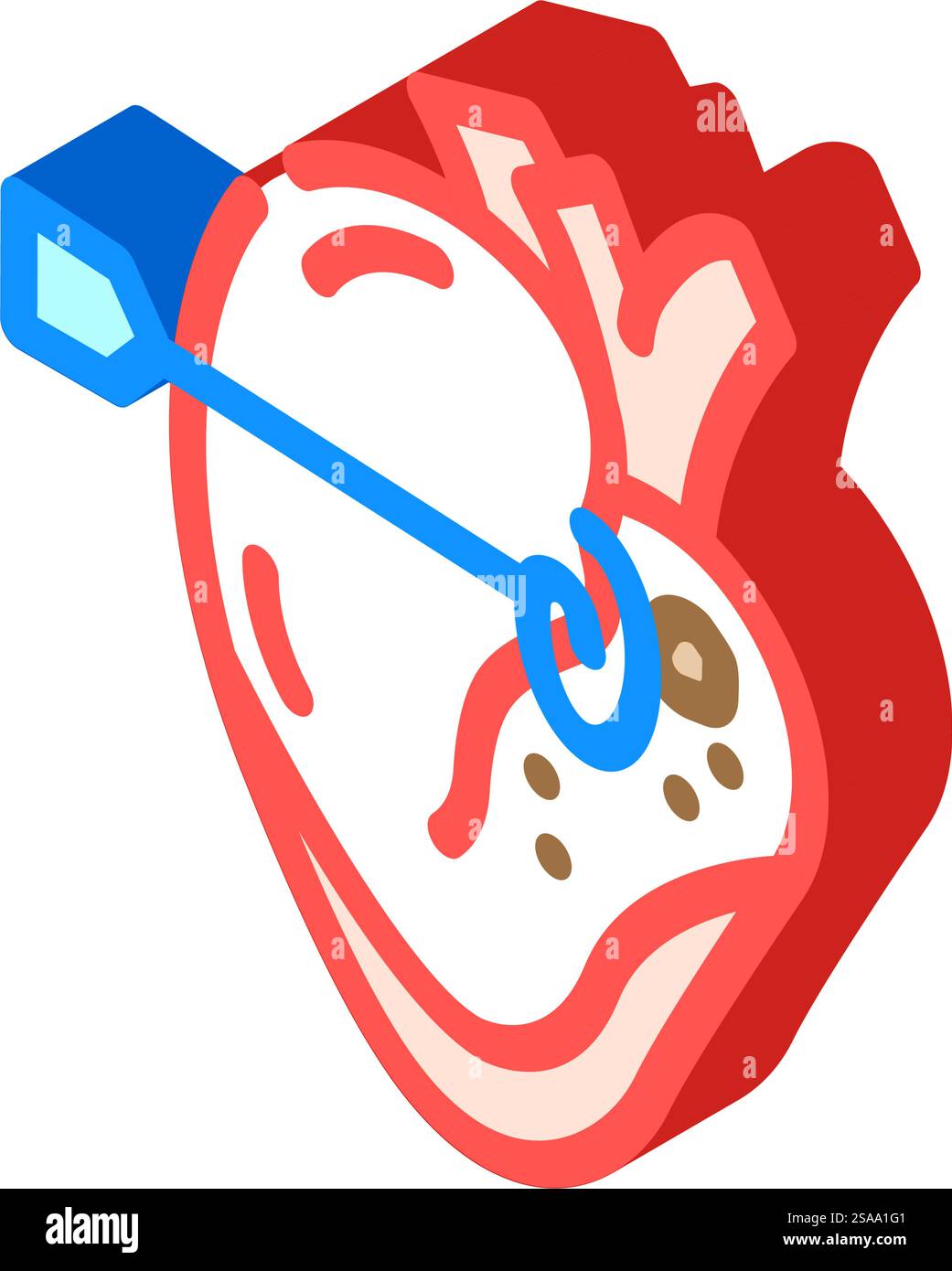 ablation surgery isometric icon vector. ablation surgery sign. isolated ...