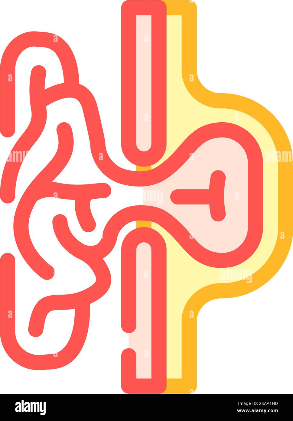 inguinal hernia repair surgery color icon vector. inguinal hernia ...