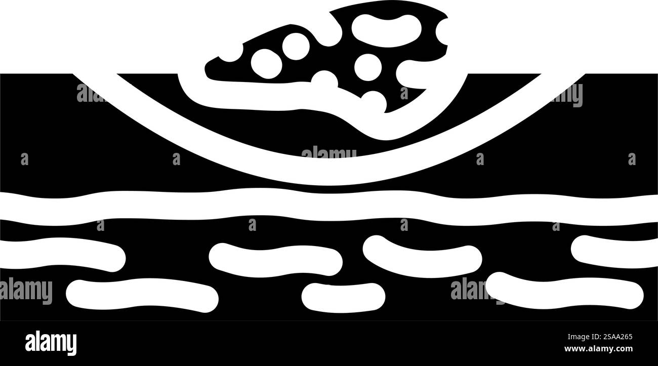excisional biopsy surgery glyph icon vector. excisional biopsy surgery ...