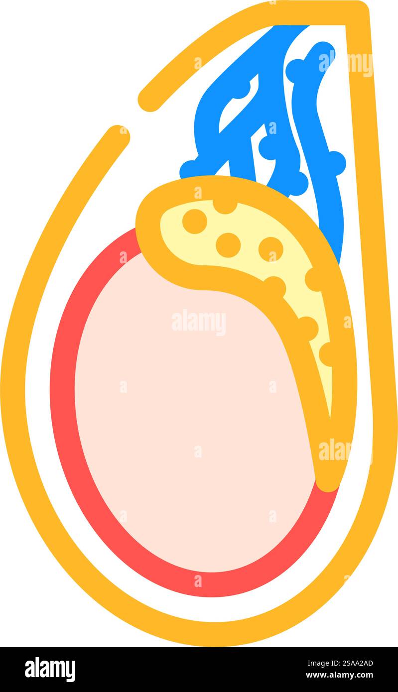 varicocelectomy surgery color icon vector. varicocelectomy surgery sign ...