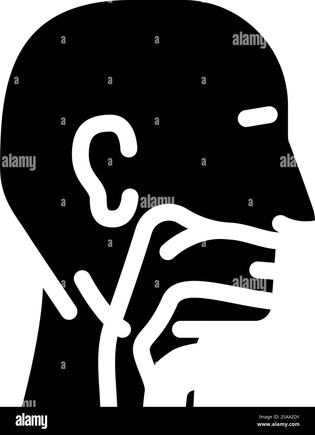 laryngectomy surgery glyph icon vector. laryngectomy surgery sign ...