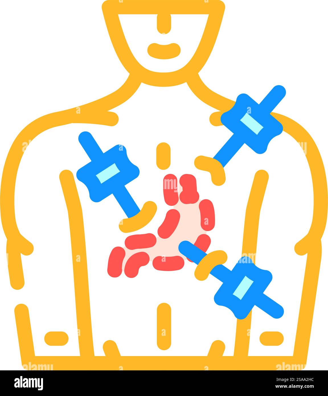 laparoscopy surgery color icon vector. laparoscopy surgery sign ...