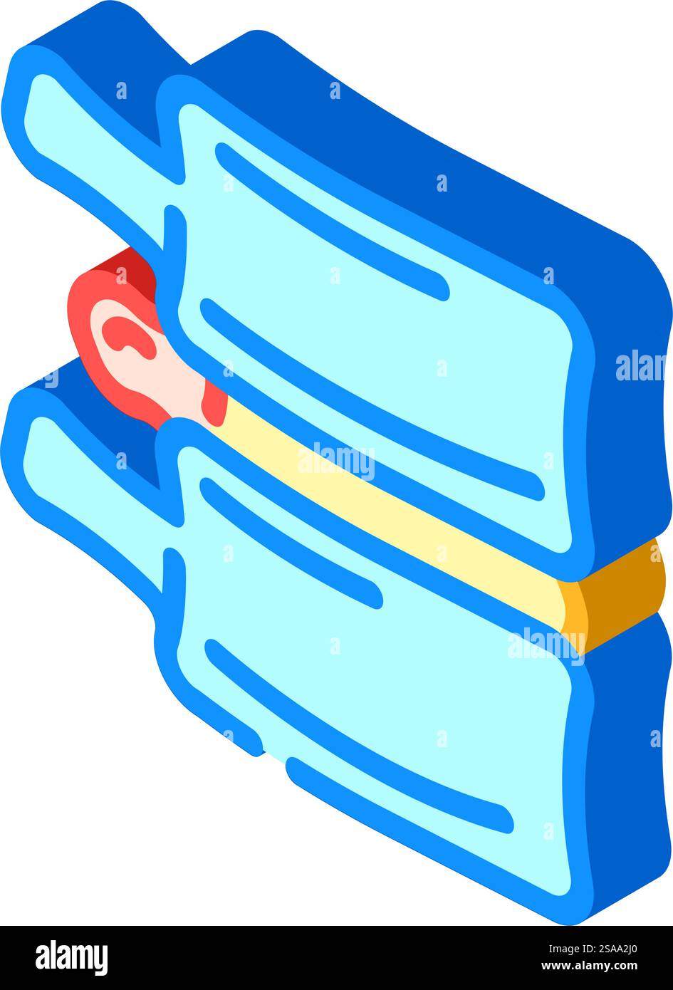 discectomy surgery isometric icon vector. discectomy surgery sign ...