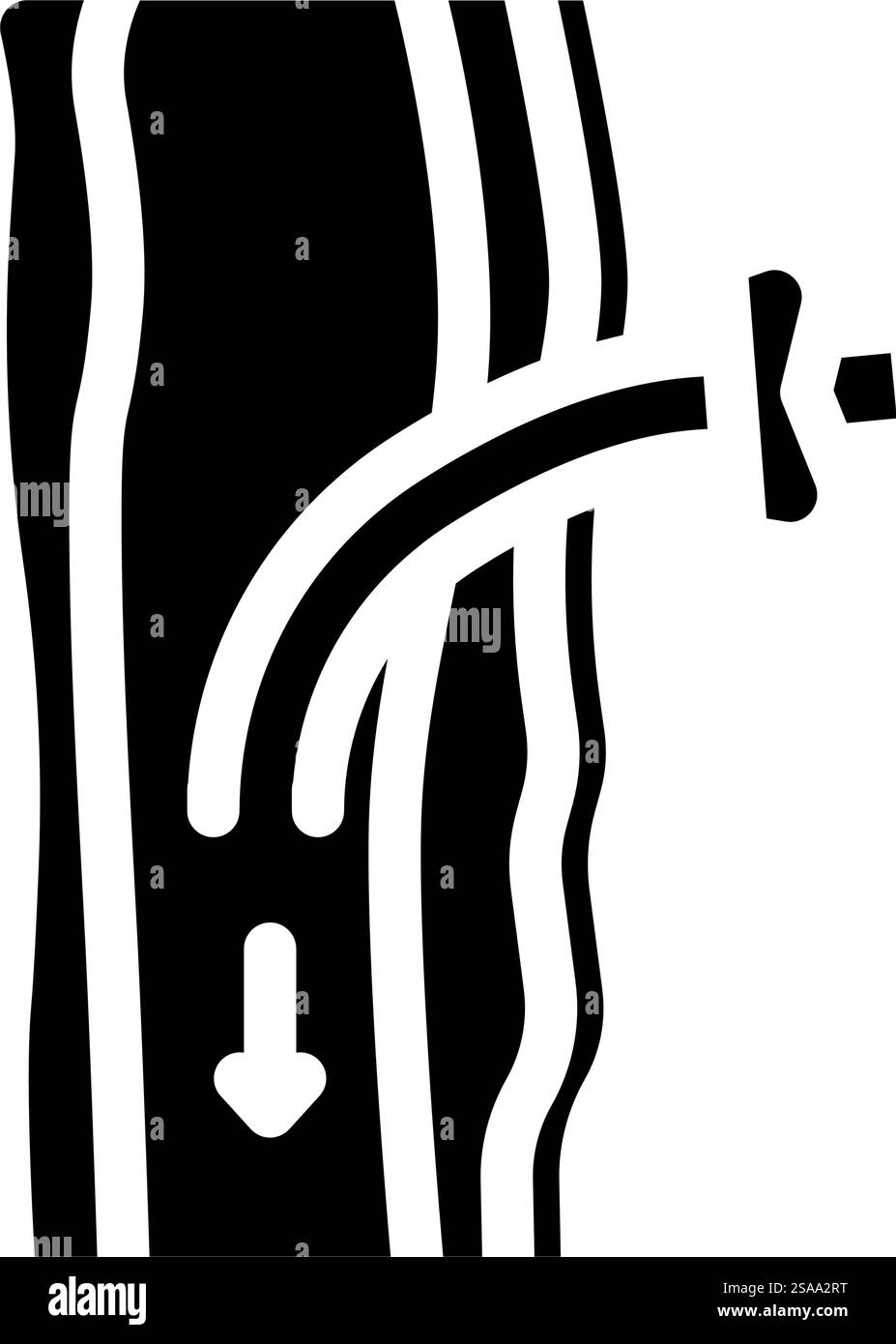 tracheostomy surgery glyph icon vector. tracheostomy surgery sign ...