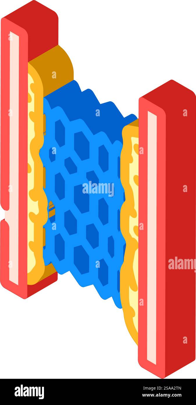 stent placement surgery isometric icon vector. stent placement surgery ...