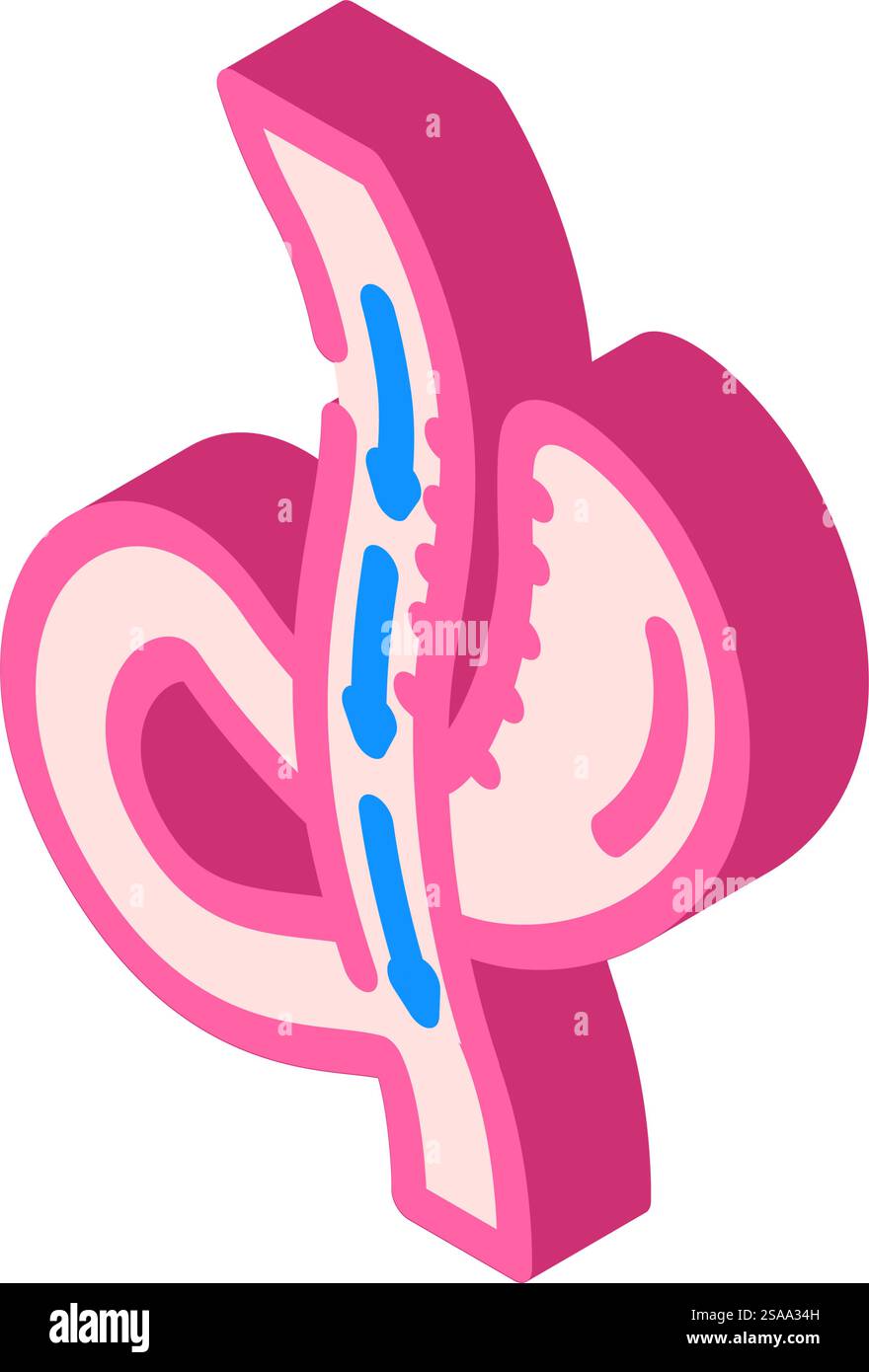 anastomosis surgery isometric icon vector. anastomosis surgery sign ...